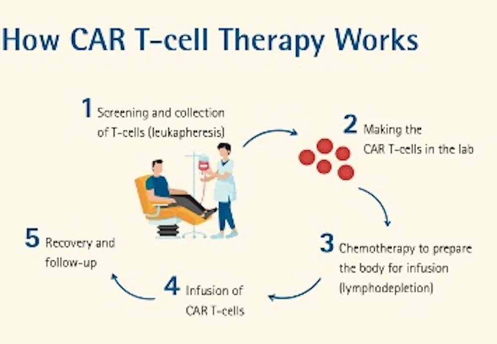 How CAR T-Cell Therapy is Changing the Landscape of Cancer Care ...