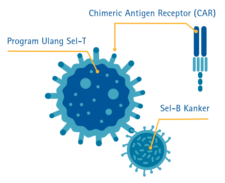Terapi Sel T Chimeric Antigen Receptor (CAR) | Parkway Cancer Centre ...